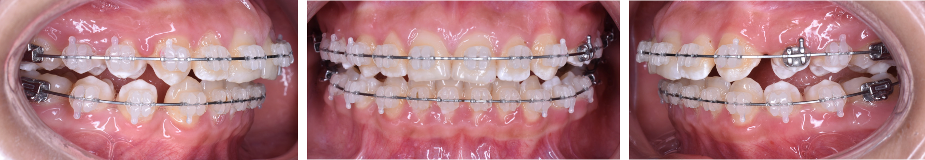 Ortodoncia | Orthodent