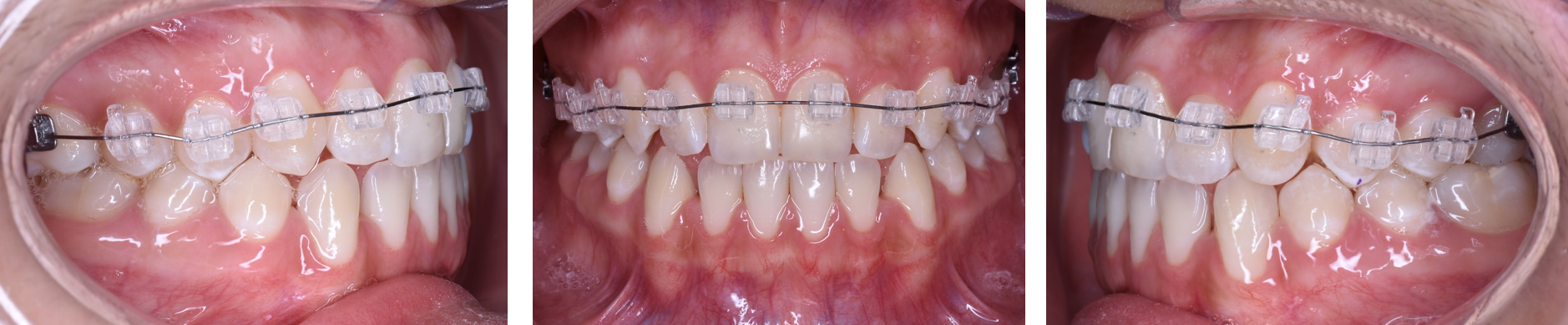 Ortodoncia | Orthodent
