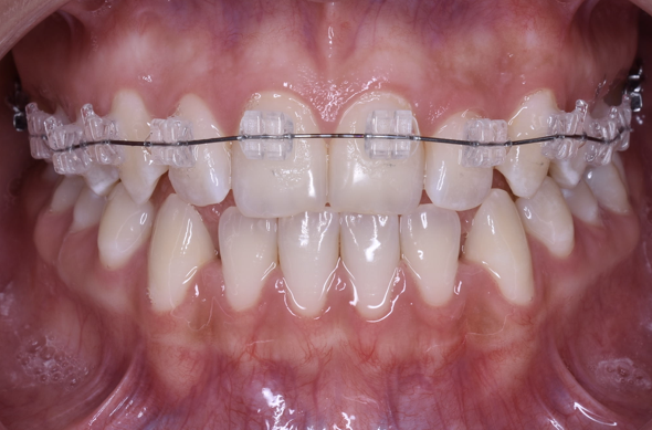 Ortodoncia | Orthodent